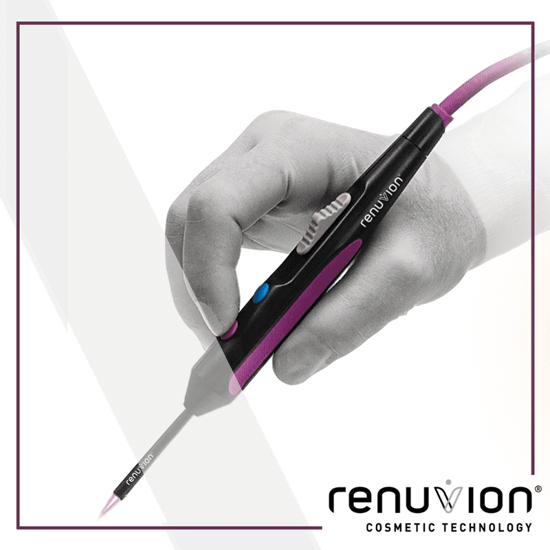 Renuvion - Plastic Surgery Chicago Illinois